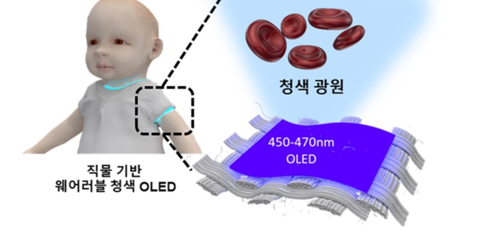 KAIST, '입는 OLED'로 소아 황달 고친다