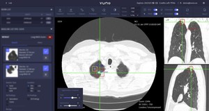 Vuno, two types of AI medical devices received certification from the ...